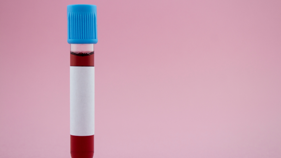 The Importance of Regular Blood Testing for Overall Health - Hodgson